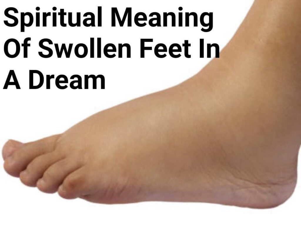 Spiritual Meaning Of Swollen Feet In A Dream Dreampeas